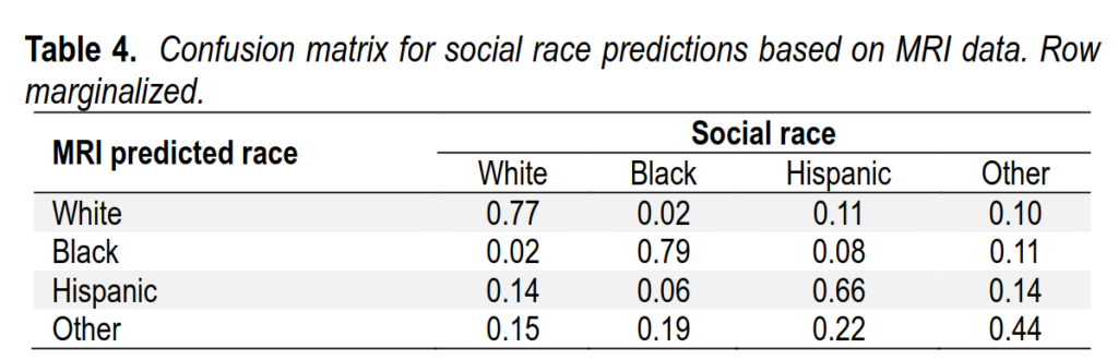 Modern neuroscience confirms race differences in brain size and ...