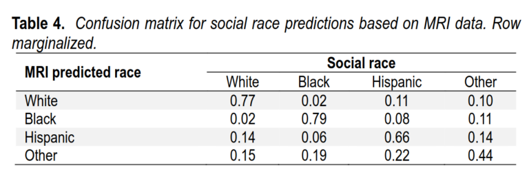 Modern neuroscience confirms race differences in brain size and ...